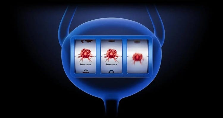 The high stakes of high-risk NMIBC